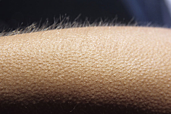 Why Is The Hair On Your Head Different From Body Hair – DermMatch UK