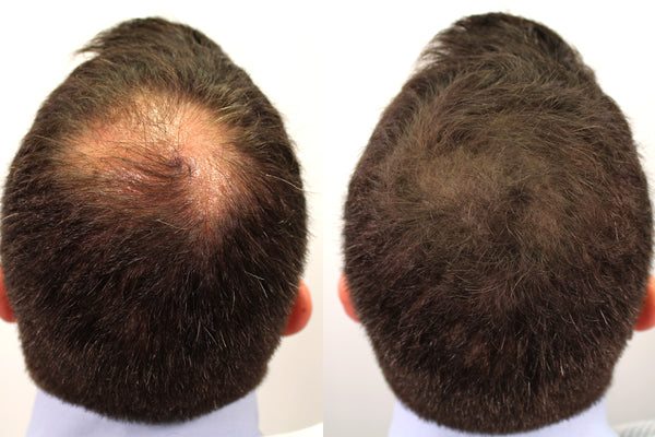 DermMatch FAQ's – DermMatch UK