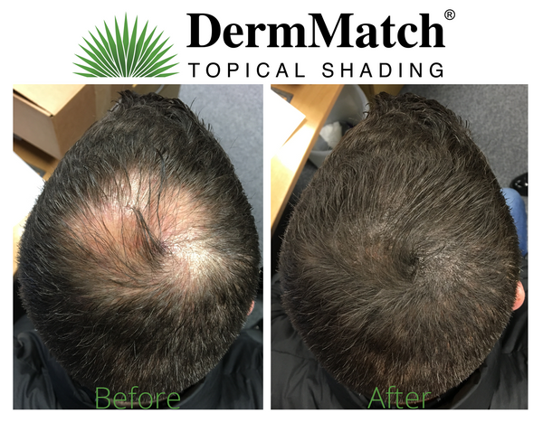 DermMatch UK | 5 important steps to help your hair stay healthy!